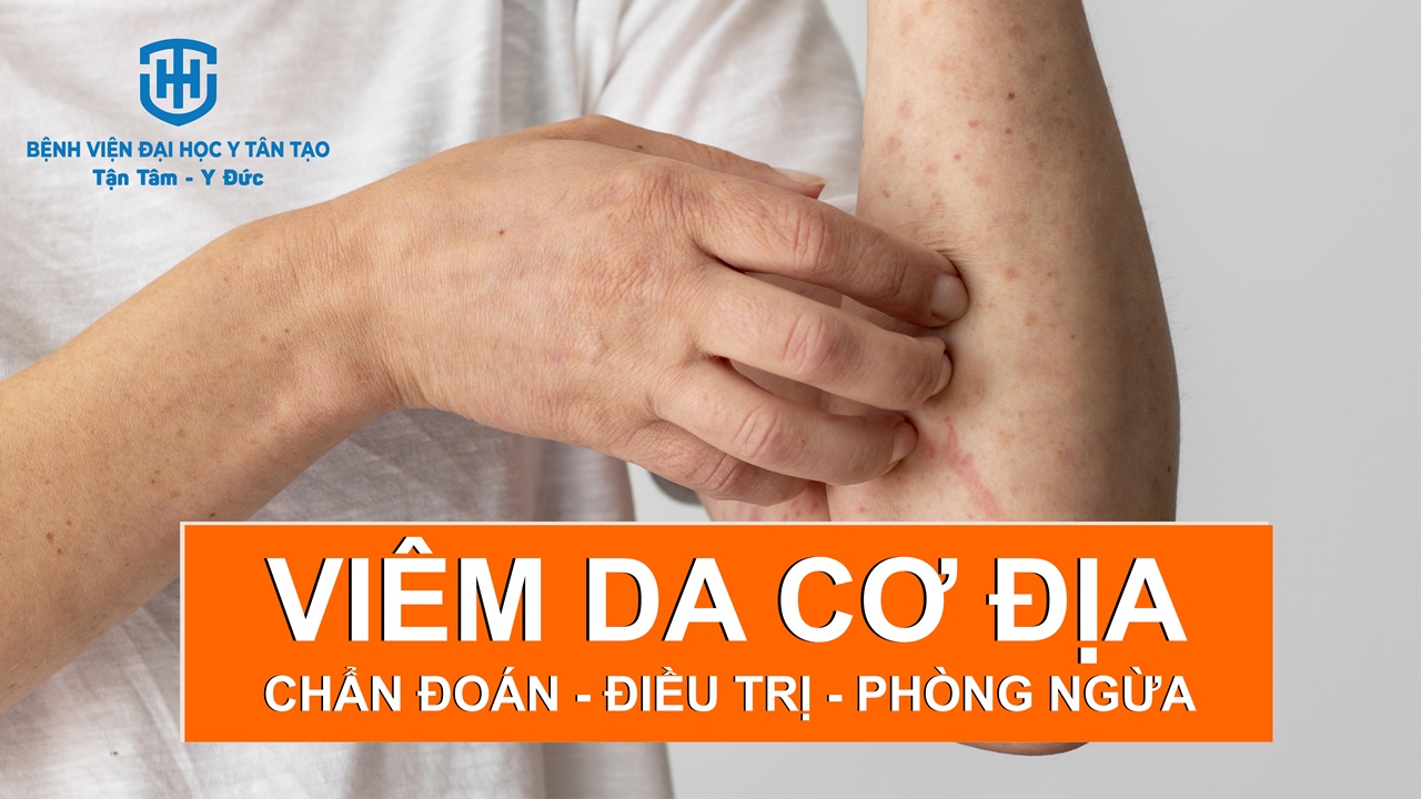 Viêm da cơ địa: Nguyên nhân, triệu chứng và cách phòng ngừa - Bệnh viện ...